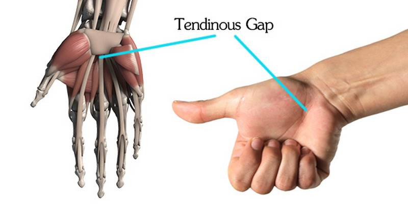 Proko - How to Draw Hands – Muscle Anatomy of the Hand