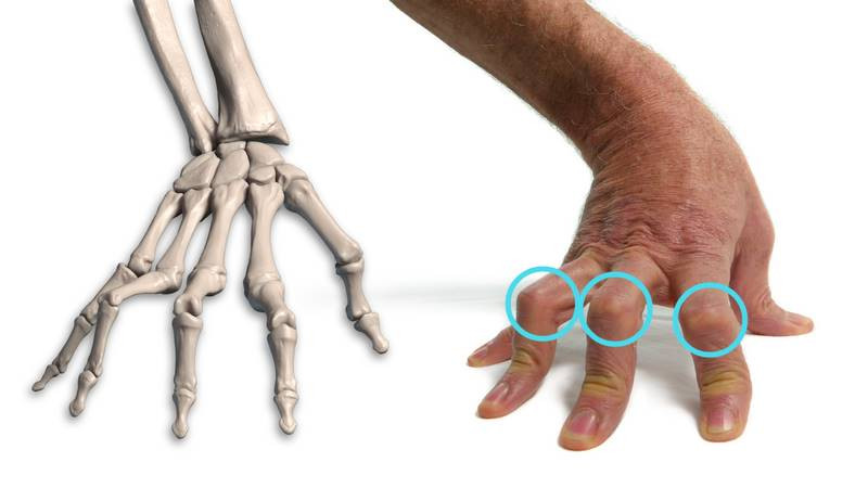 Proko - How to Draw Hands – Muscle Anatomy of the Hand