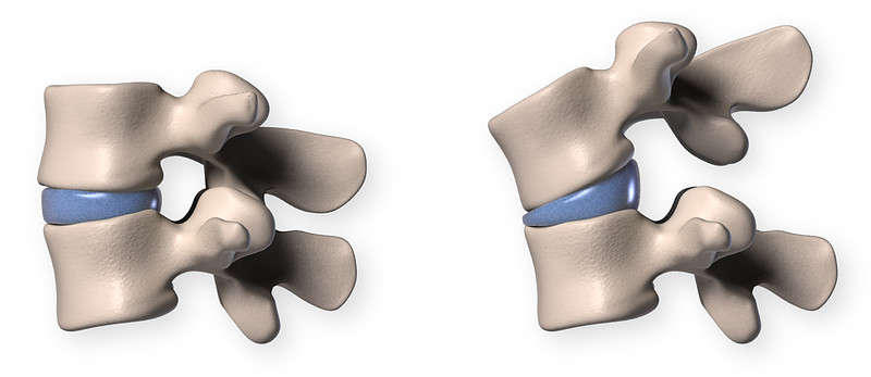 Proko - Anatomy of the Spine